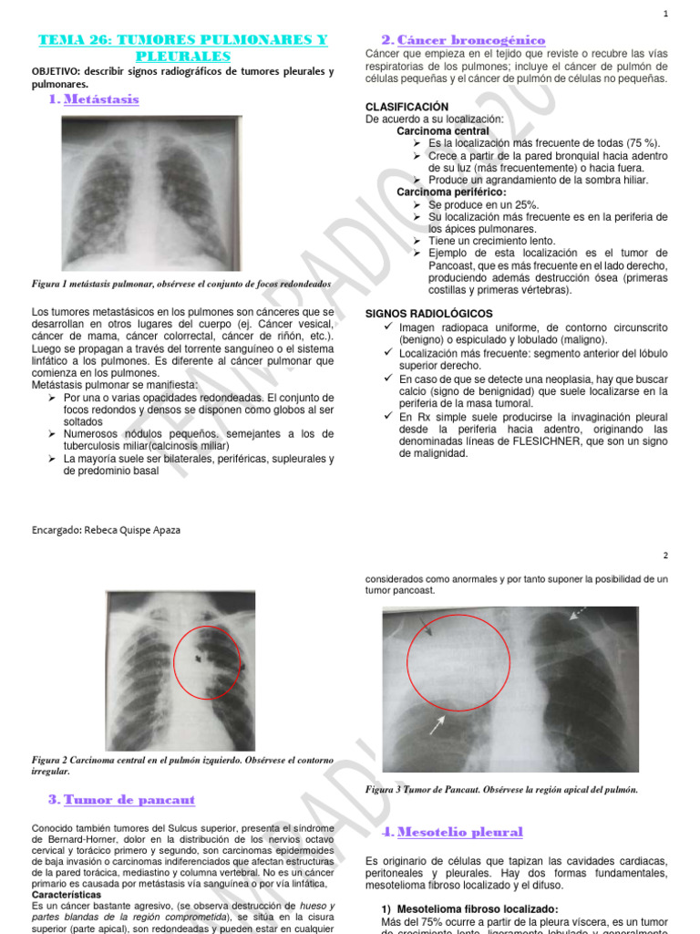 Tema 26 Tumores Pulmonares | Descargar gratis PDF | Cáncer de pulmón | Cáncer