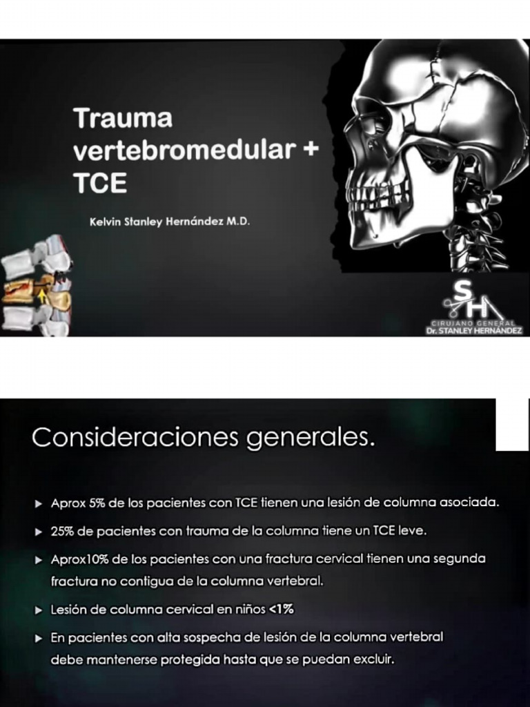 Trauma Vertebromedular - TCE Part 1 y 2 | PDF | Médula espinal | Anatomía