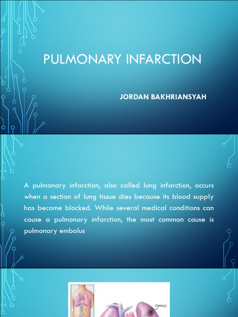 Pulmonary Infarction | Download Free PDF | Lung | Thorax