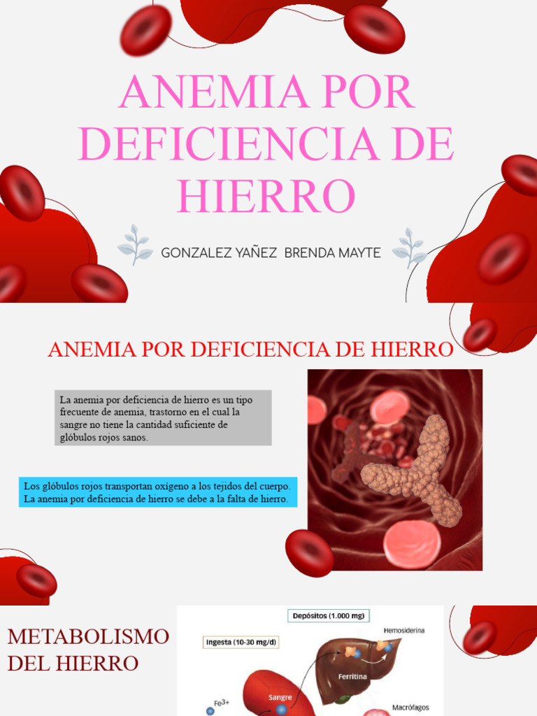 Anemia Por Deficiencia de Hierro | PDF | Especialidades Medicas ...