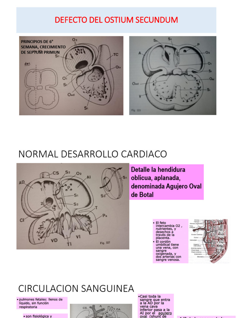 DEFECTO DEL OSTIUM SECUNDUM y PRIMUM | PDF | Defecto cardiaco congenito ...