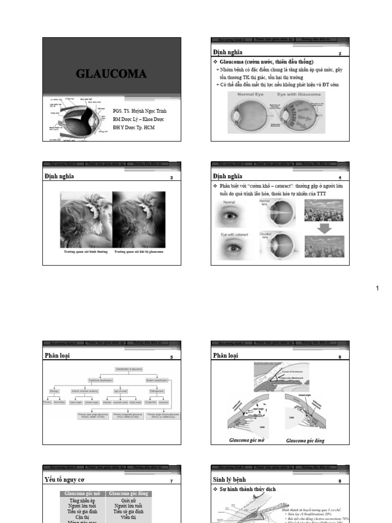 Glaucoma | PDF