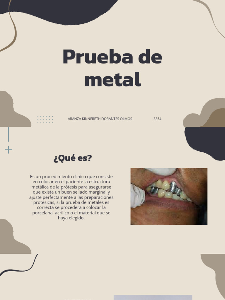 Prueba de Metal | PDF | Materiales | Rieles