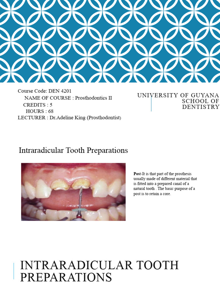 Intraradicular Tooth Prep | PDF | Dentistry | Mouth