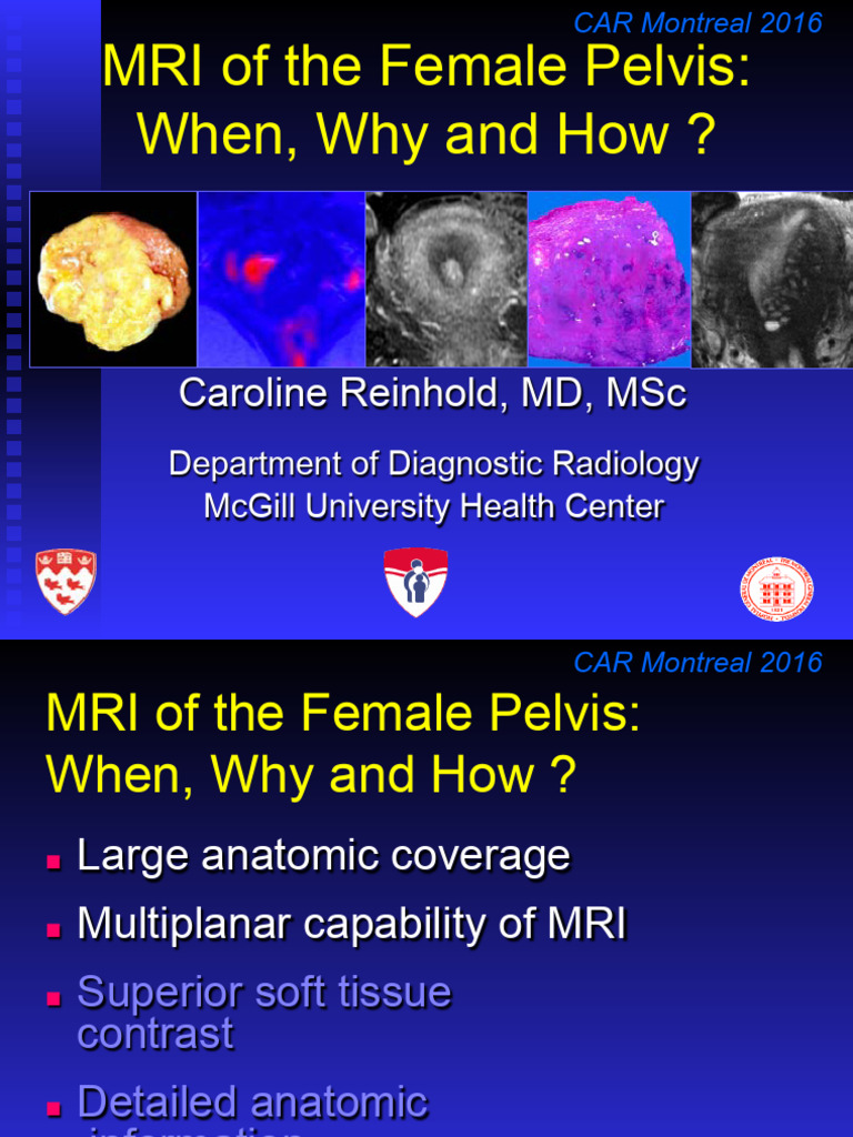 MRI of the Female Pelvis Explained | PDF | Biopsy | Cervical Cancer
