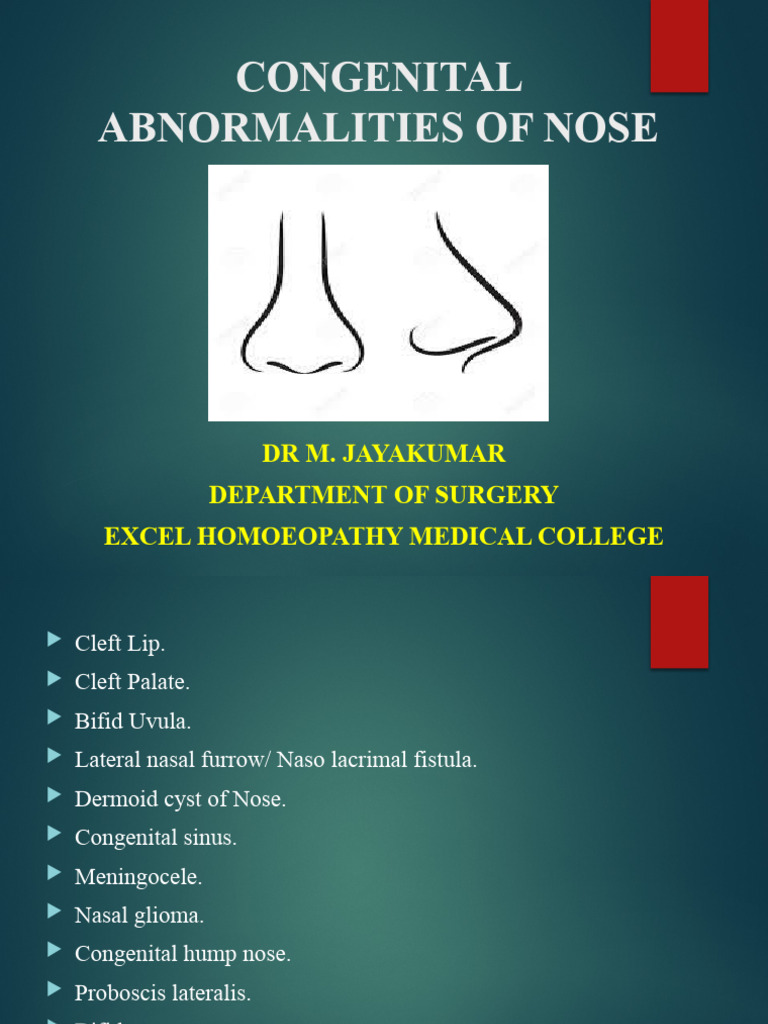 Congenital Abnormalities of Nose | PDF