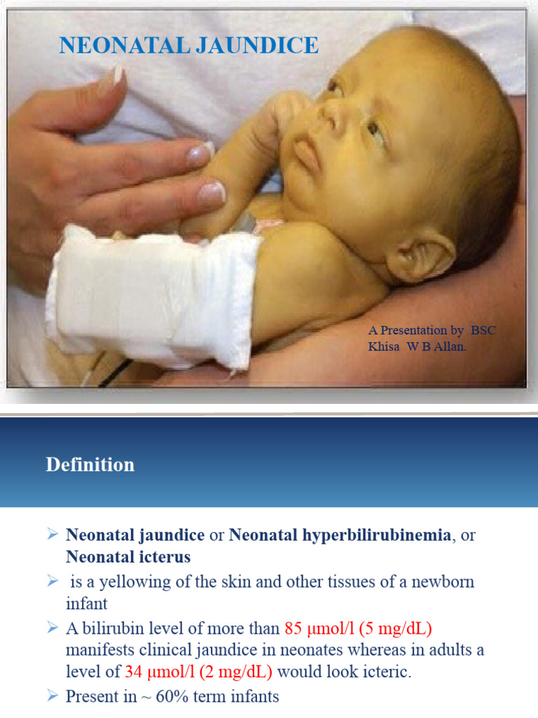 7.Neonatal Jaundice | PDF | Breastfeeding | Medical Specialties