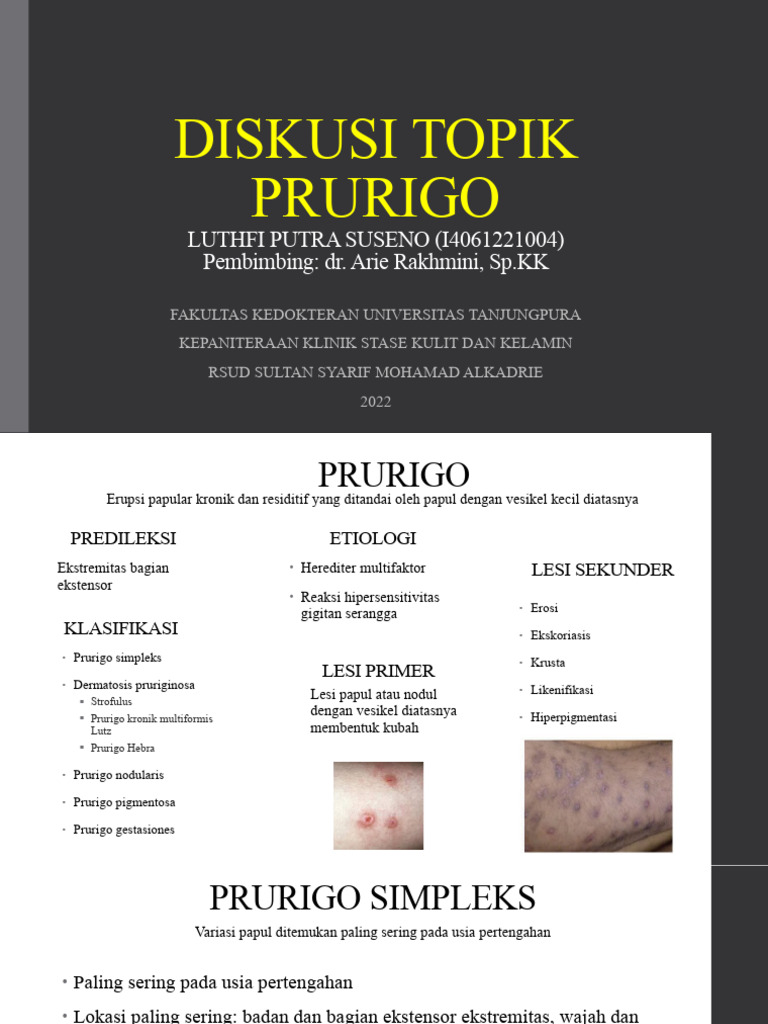 DISKUSI TOPIK PRURIGO | PDF