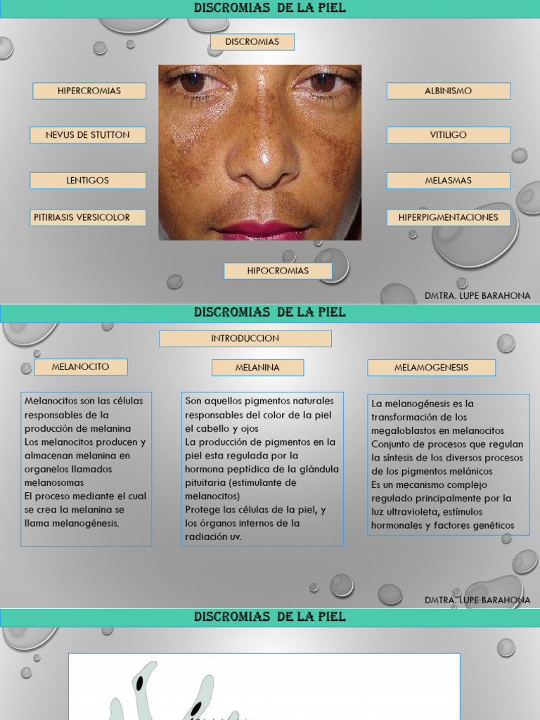 Discromias Cutaneas Facial-1 | PDF | Piel | Epidermis