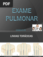 Tórax tonel, pectus carinatum e pectus exacavatum | PDF | Doença de ...