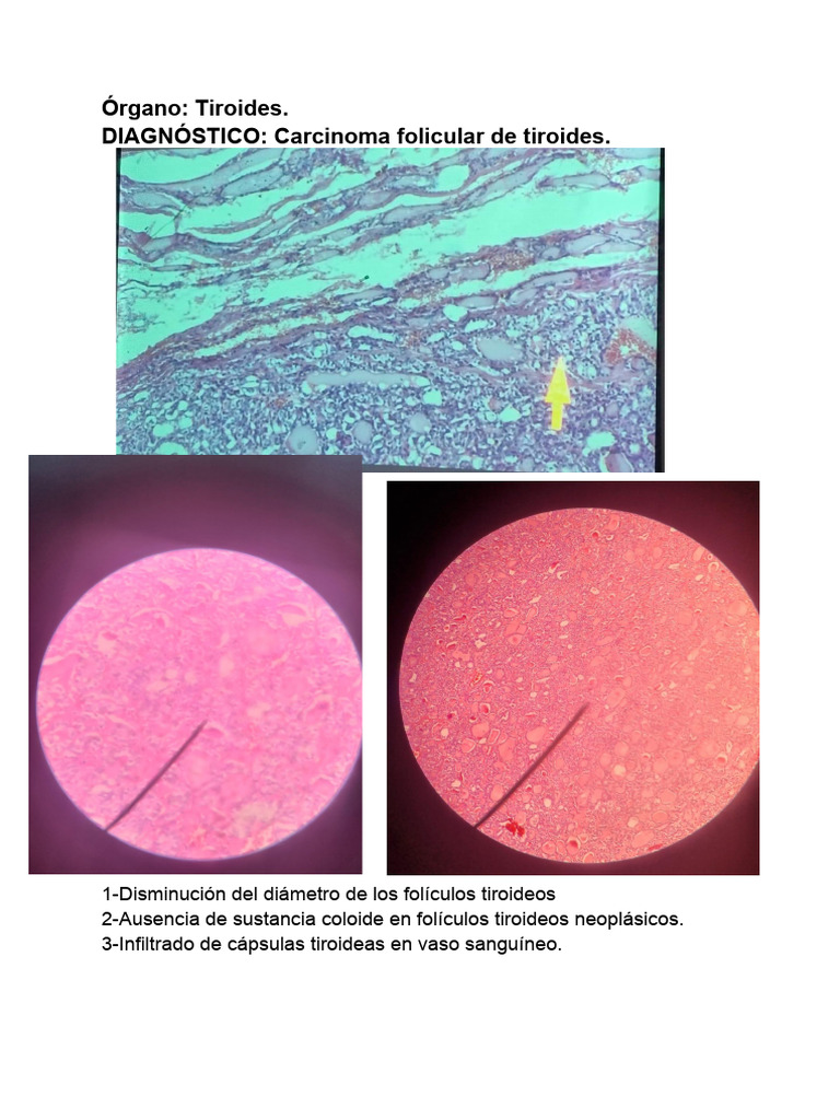 PC3 Saravia Parte 2 | PDF
