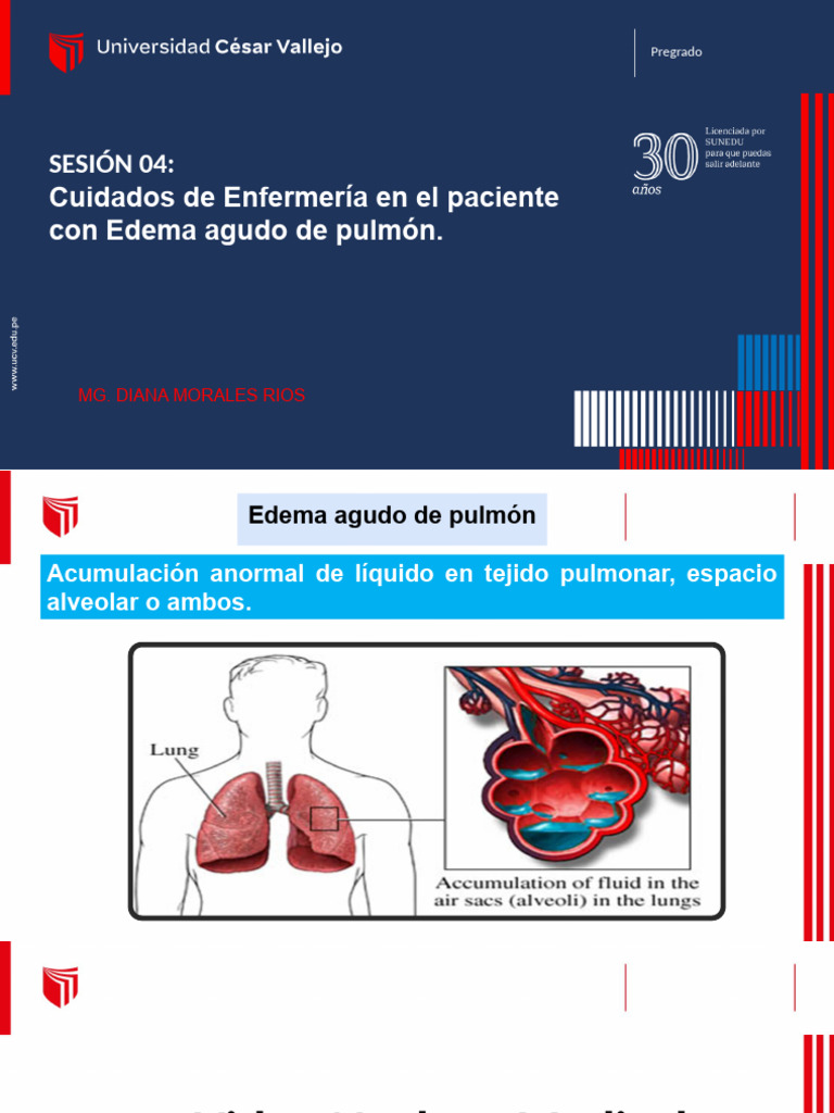 Sesion 4 - Cuidado de Enfermeria A Un Paciente Con Edema Agudo de ...