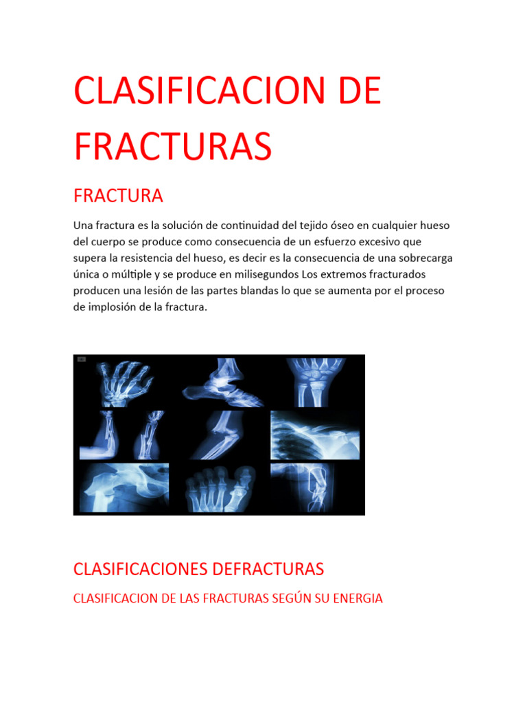 Clasificacion de Fracturas | Descargar gratis PDF | Hueso | Sistema musculoesquelético