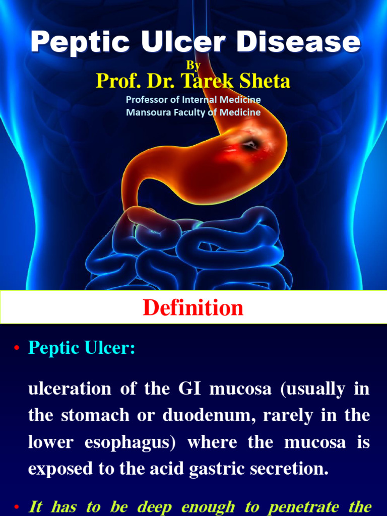 Peptic Ulcer Disease TAREK SHETA | PDF | Clinical Medicine ...
