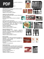 2da Clase - Endodoncia - Diagnostico Pulpar y Periapical | PDF | Odontología | Enfermedades y ...