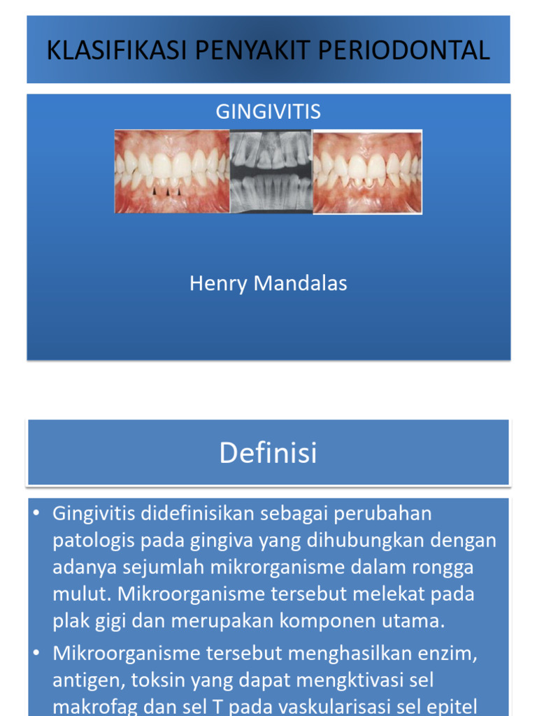 Gingivitis | PDF