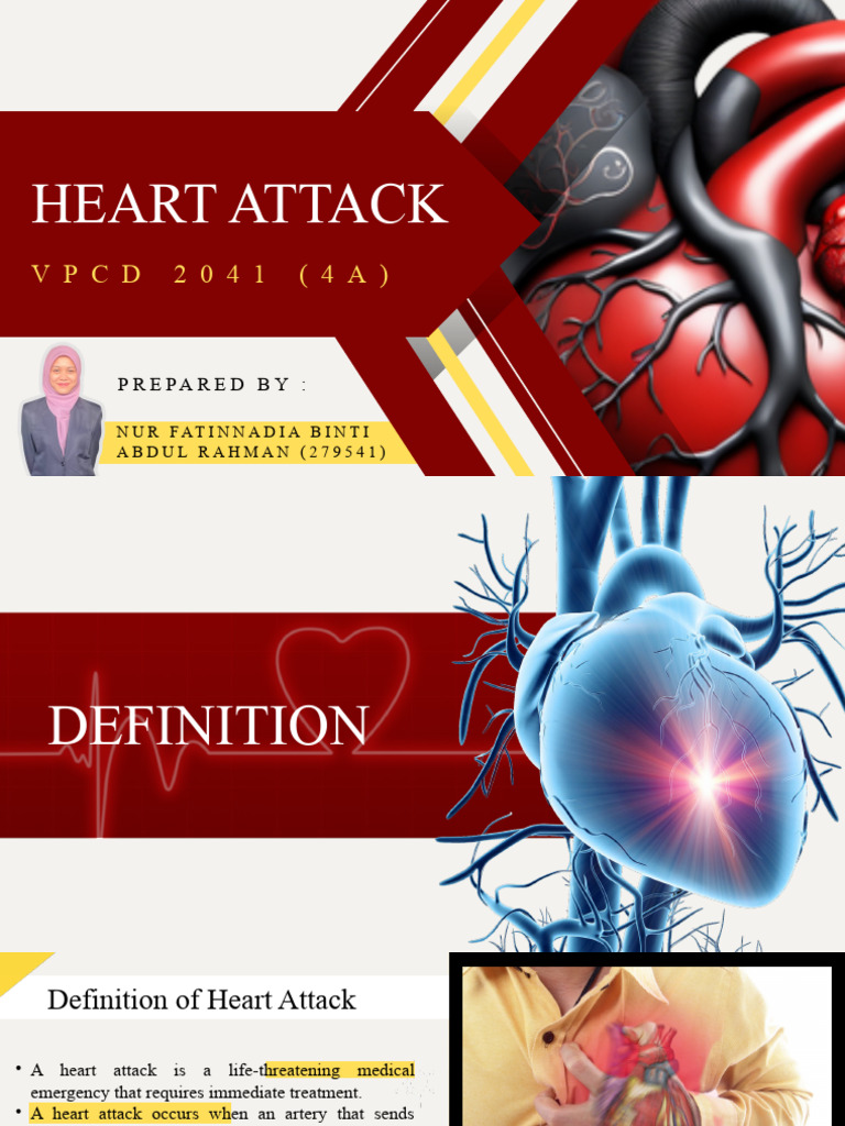 HEART ATTACK | Download Free PDF | Myocardial Infarction | Heart