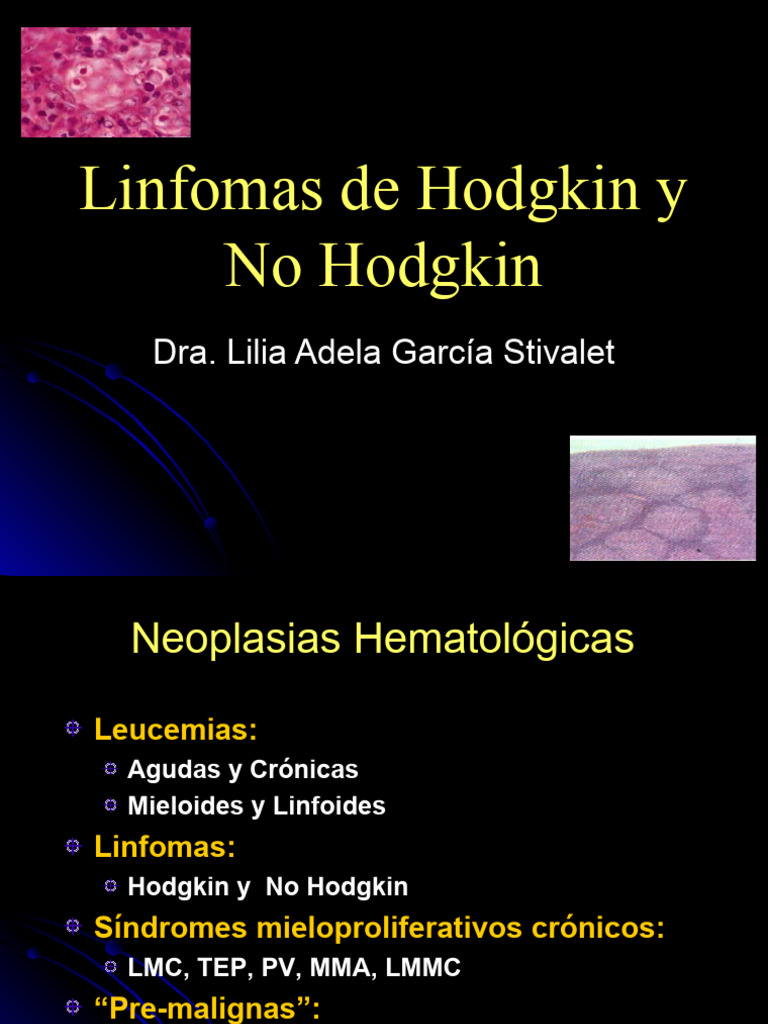 Linfomas de Hodgkin y No Hodgkin: Guía Completa | PDF | Linfoma | Cáncer