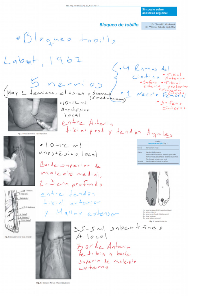 Bloqueo de Tobillo PDF | PDF