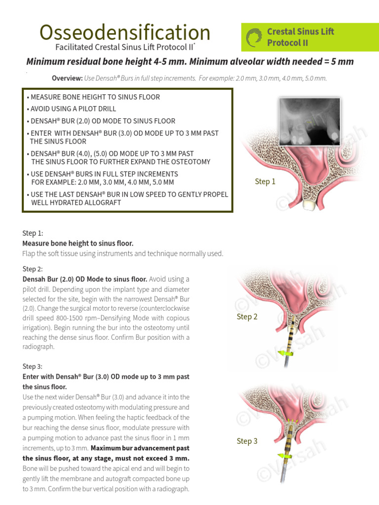 Versah abordaje transcrestal con injerto | PDF