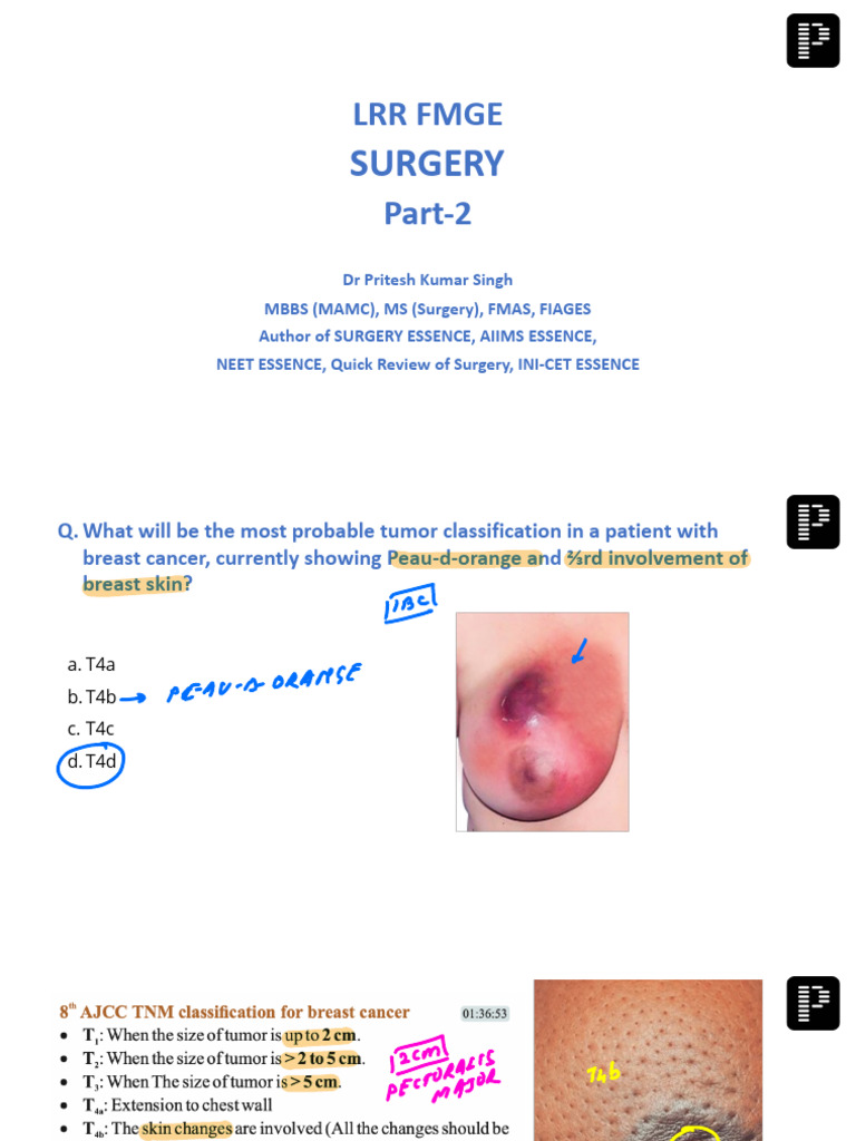 LRR FMGE Surgery Part 2 | PDF | Shock (Circulatory) | Breast Cancer