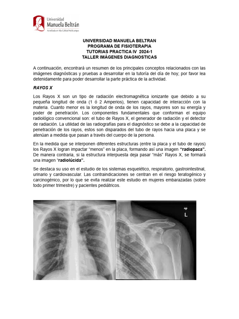 TALLER IMÁGENES DIAGNOSTICAS | Descargar gratis PDF | Electrocardiografia | Electromiografia