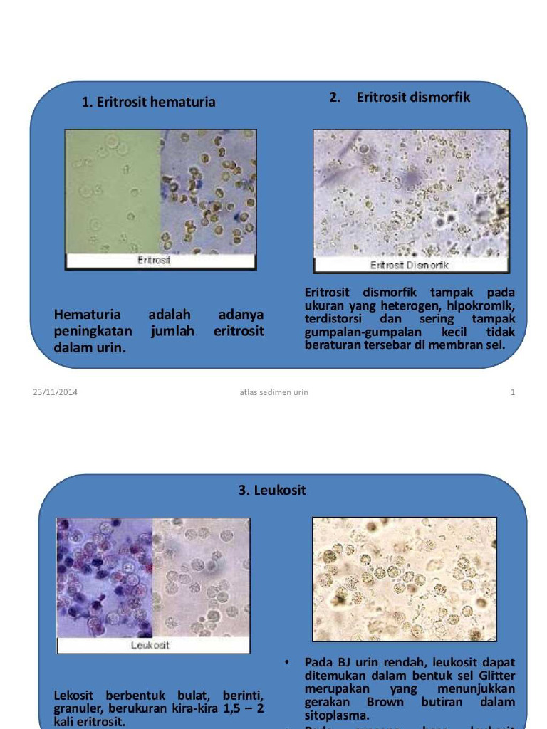 Atlas Sedimen Urin | PDF