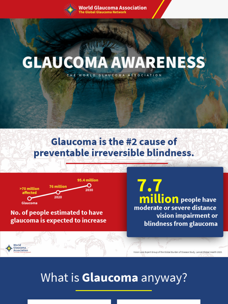 Understanding Glaucoma: Risks and Treatments | PDF | Glaucoma | Visual ...