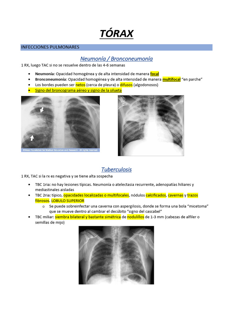 TÓRAX RX | PDF | Pulmón | Cáncer de pulmón