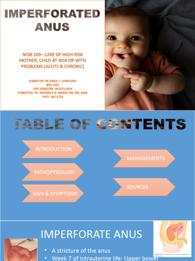 Understanding Imperforate Anus in Infants | PDF | Rectum | Gastroenterology