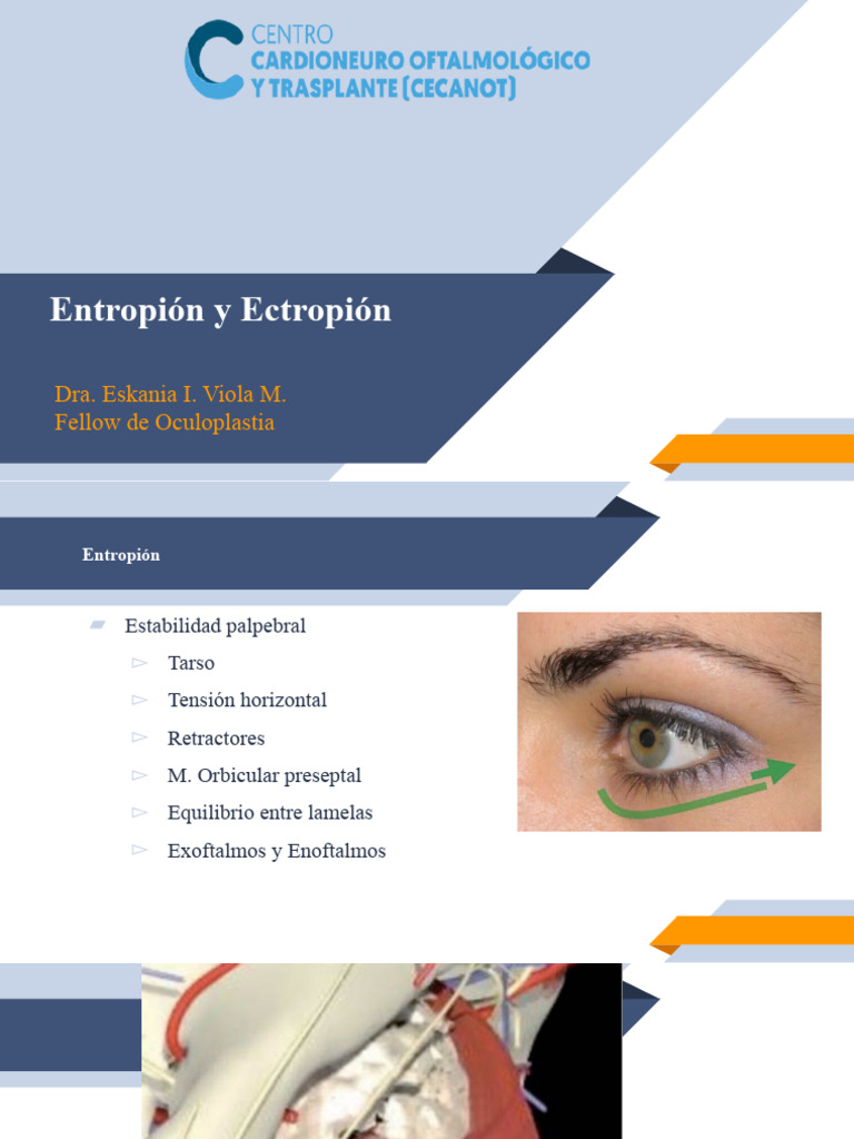 Entropión y Ectropión: Guía Clínica | PDF | Enfermedades y trastornos | Oftalmología