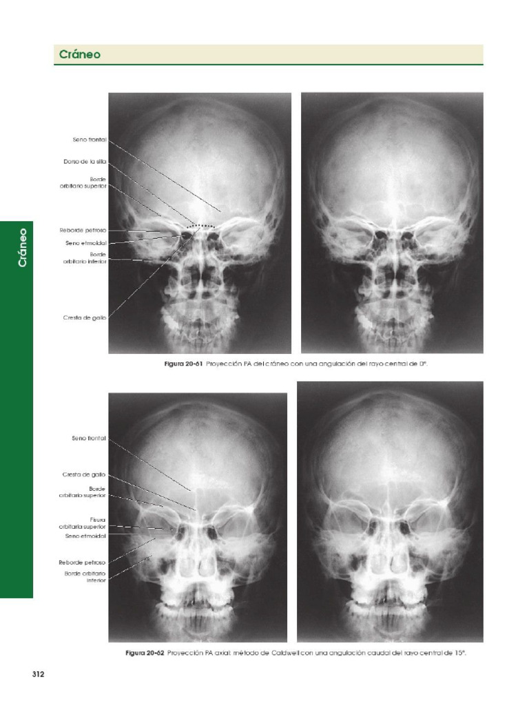 Merril- craneo | PDF