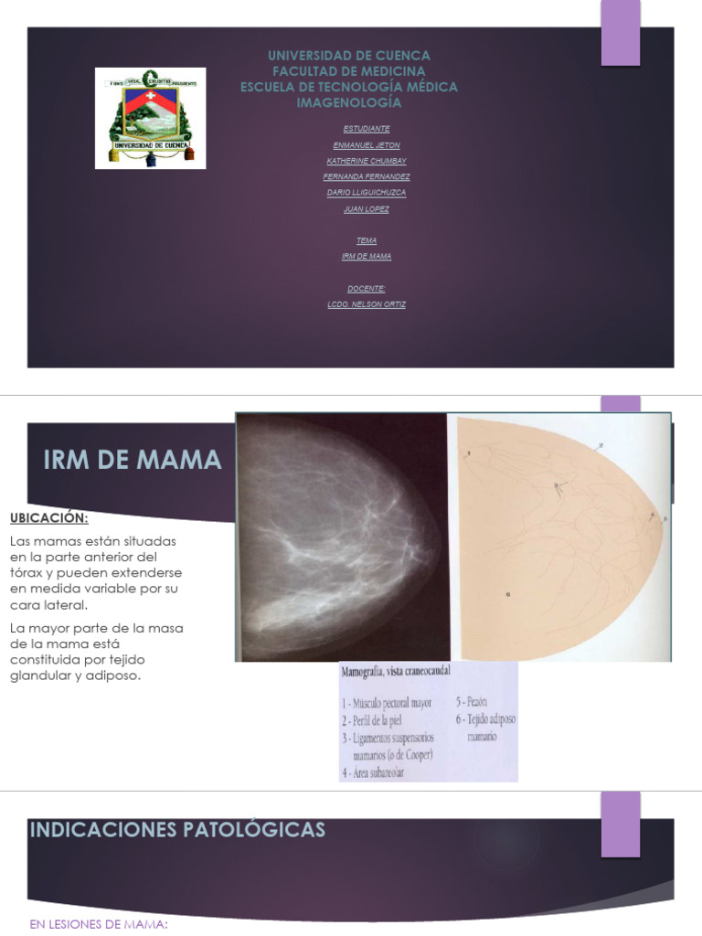 irm_de_mama | PDF | Pecho | Medicina