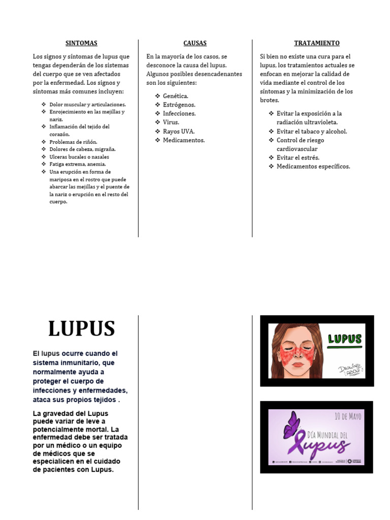 Síntomas y tratamiento del lupus | PDF