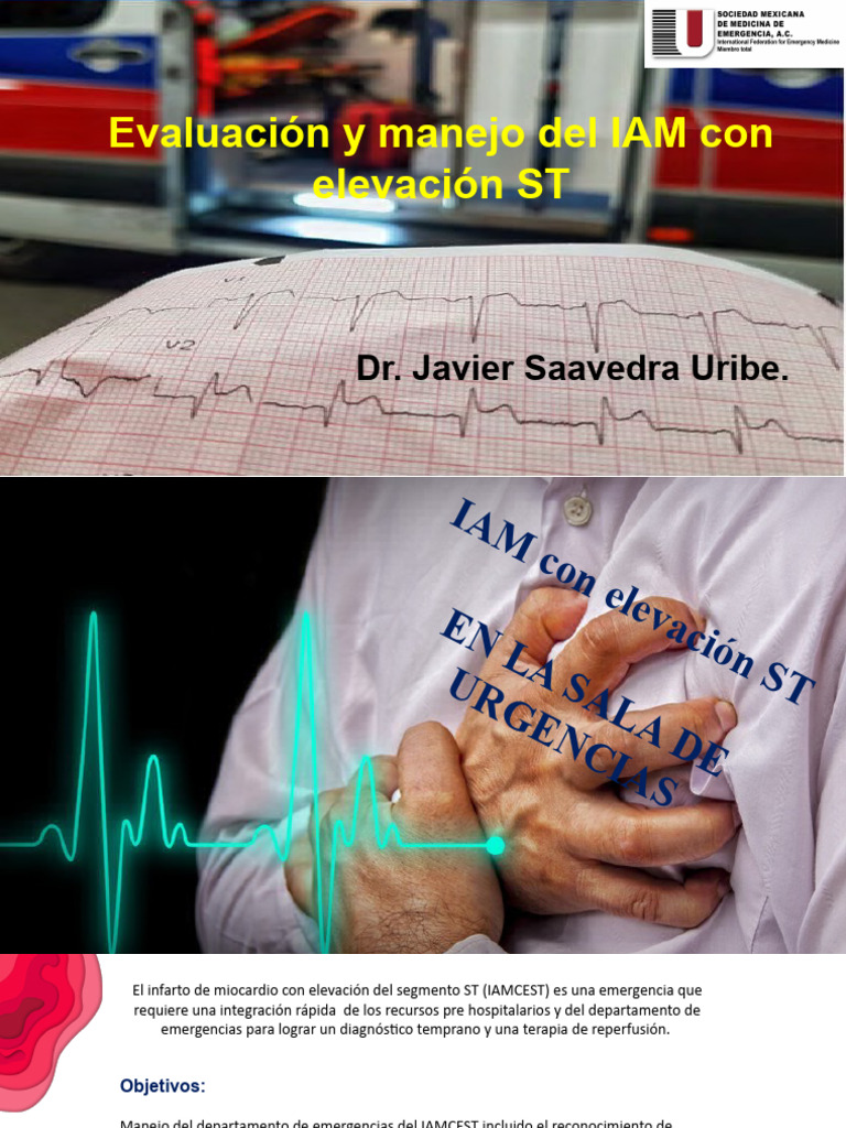 Evaluación y Manejo Del IAM Con Elevación ST Abril 2021 | Descargar gratis PDF | Infarto de ...