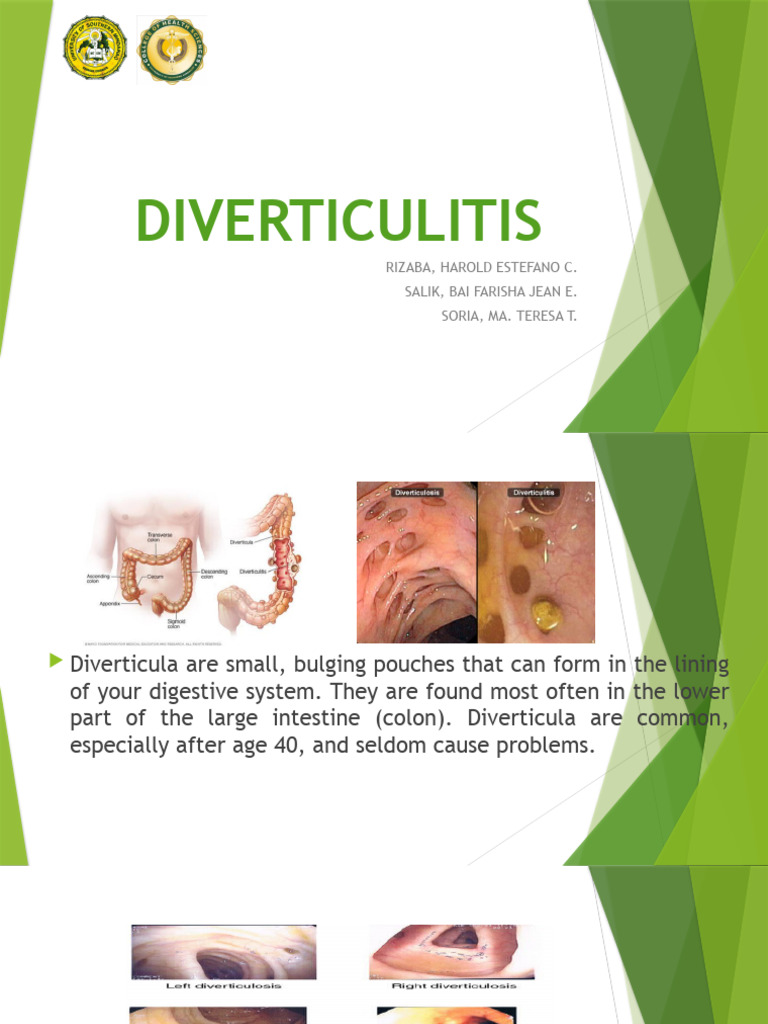 Diverticulitis Lecture NCM | PDF | Constipation | Medical Specialties