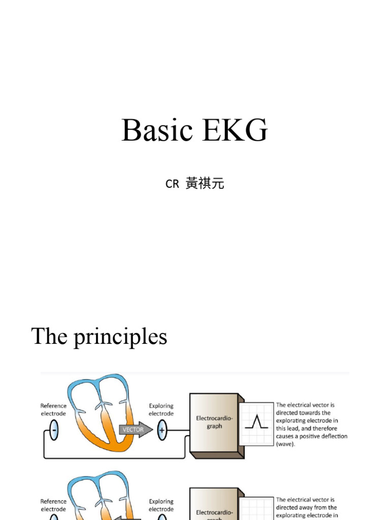 Basic EKG | PDF | Electrocardiography | Myocardial Infarction
