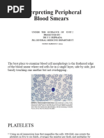 Pencil Cells in Iron Deficiency Anemia | PDF | Anemia | Hematology