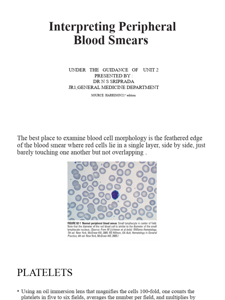 Peripheral Blood Smear | PDF | White Blood Cell | Lymphocyte