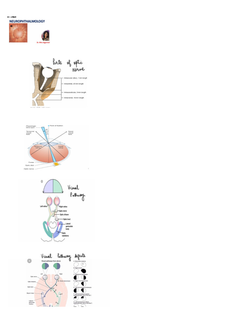 Ent | PDF