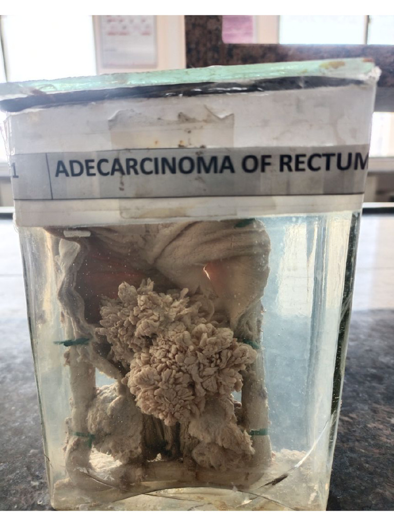 Specimen Patho MK Shah - 240531 - 222718 | PDF