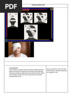 Vendaje Capelina: Procedimiento y Usos | PDF | Relaciones personales ...
