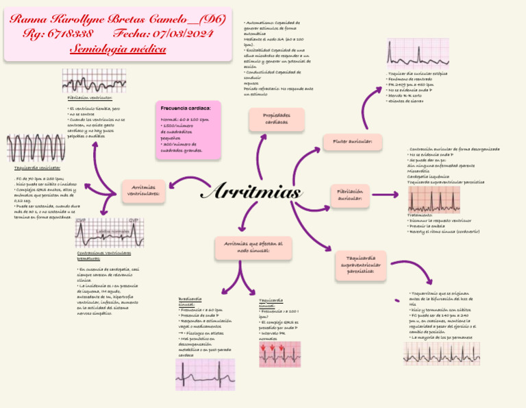 Mapa Mental De Arritmias Cardíacas Pdf Electrofisiología Cardíaca
