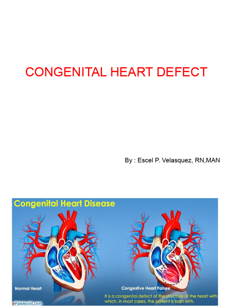 Understanding Congenital Heart Defects | PDF | Congenital Heart Defect ...