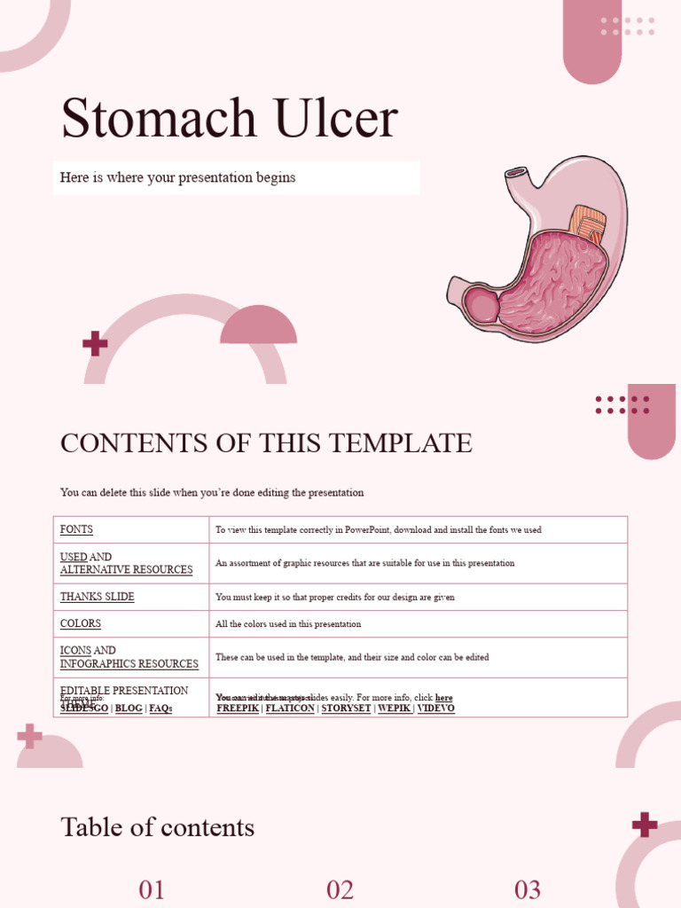 Stomach Ulcer by Slidesgo | PDF | Chronic Condition | Medical Diagnosis