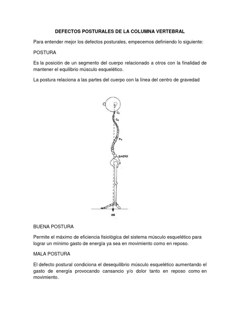 Defectos Posturales y Escoliosis | PDF | Escoliosis | La columna vertebral