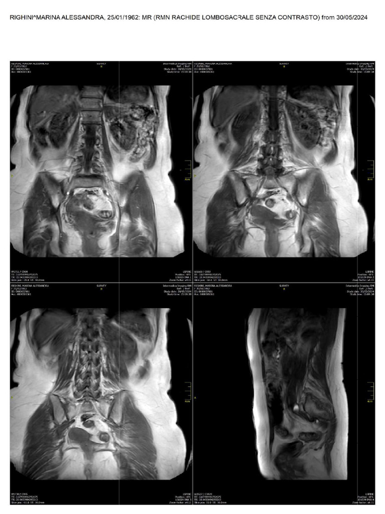 RMN Righini Marina Alessandra Completo Resizepdf | PDF