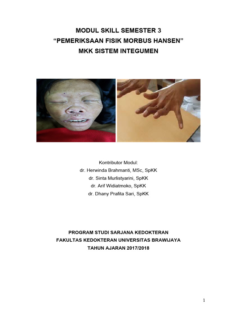 D1. Modul Pemeriksaan Fisik Morbus Hansen | PDF
