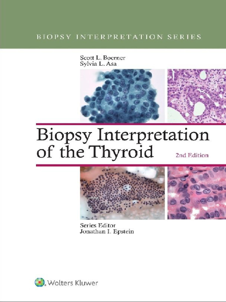 BIS-Biopsy Interpretation of The Thyroid | PDF | Thyroid | Biopsy