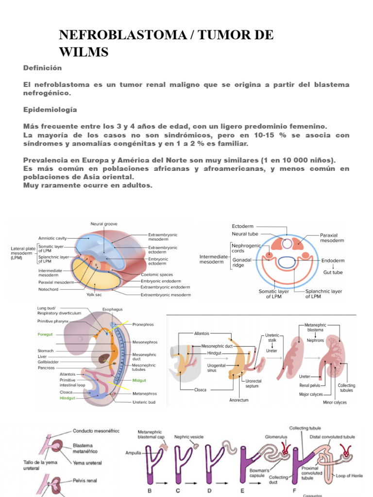 Nefroblastoma: Tumor de Wilms en Niños | PDF | Enfermedades y ...